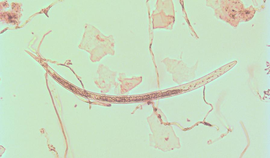 How To See Nematodes Under Microscope